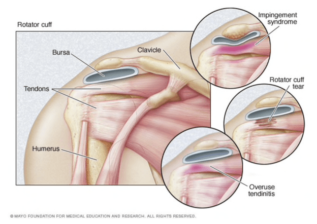 Rotator Cuff Tear Treatment in Madipakkam - Dr. Arun Kumar N